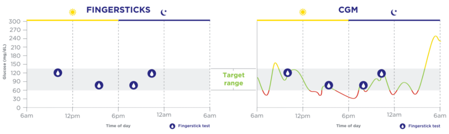 Continuous Glucose Monitoring เครื่องวัดน้ำตาลในเลือด CGM | อีไลฟ์ สินค้าสุขภาพ | Ergonomics ...
