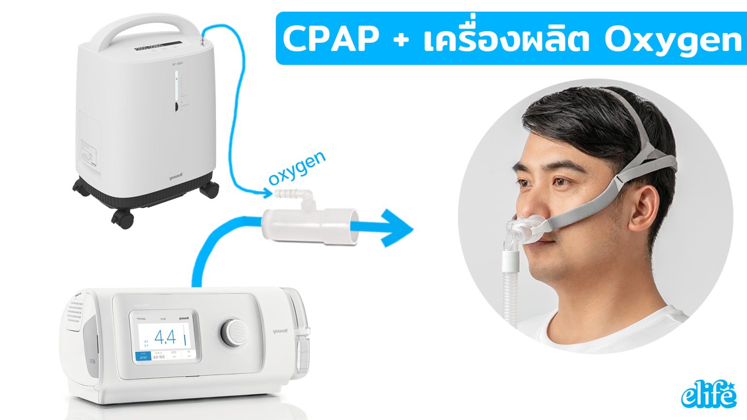 CPAP รุ่นไหนดี? 2024 เทียบสเปค ราคา ข้อดี-ข้อเสีย CPAP Guide | อีไลฟ์ ...