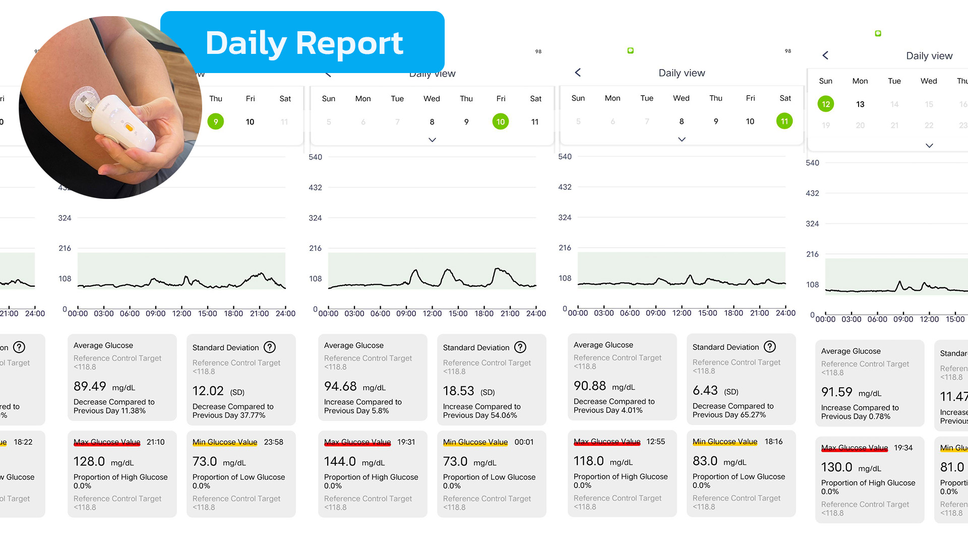 CGM 3รุ่น วัดน้ำตาล ไม่ต้องเจาะปลายนิ้ว ผ่านอย.ไทยแล้ว(2024) | อีไลฟ์ ...