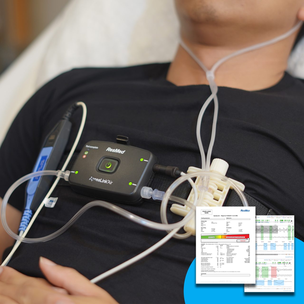 Sleep Test บริการสลีปเทส ทดสอบปัญหาการนอน อาการหยุดหายใจ กรน | อีไลฟ์ ...